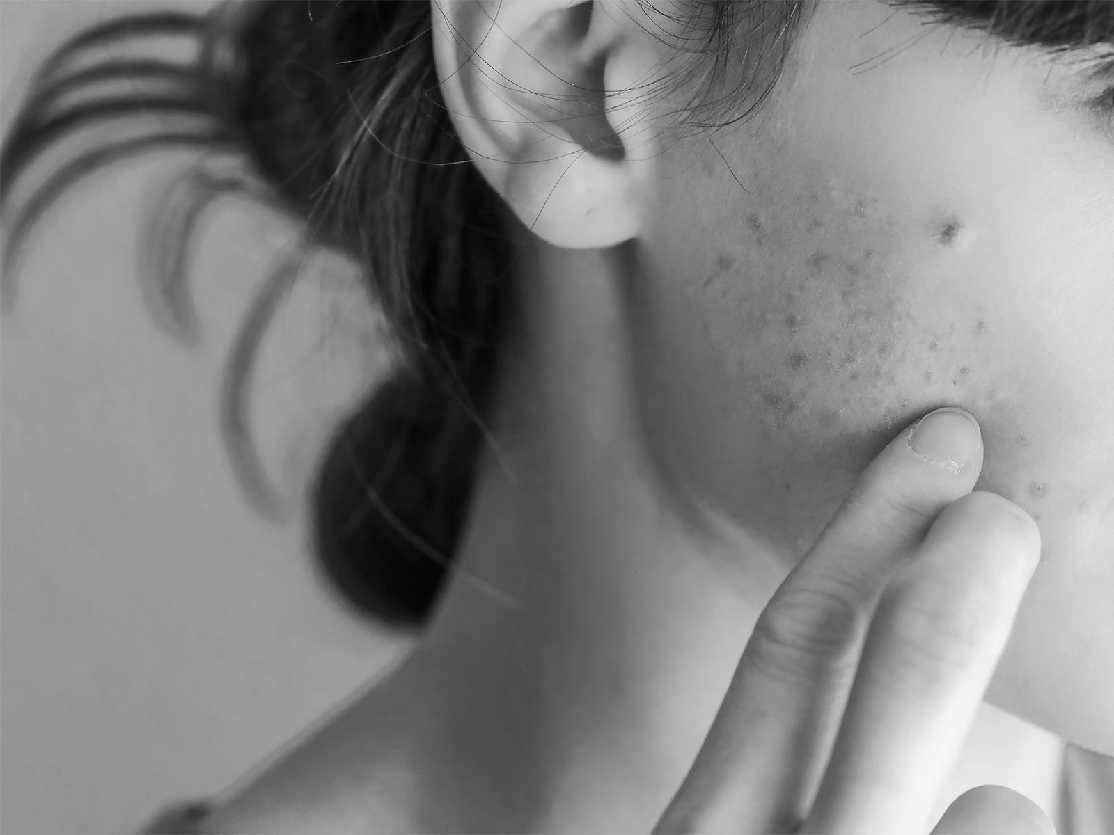 Teenagers – BFFECT USA